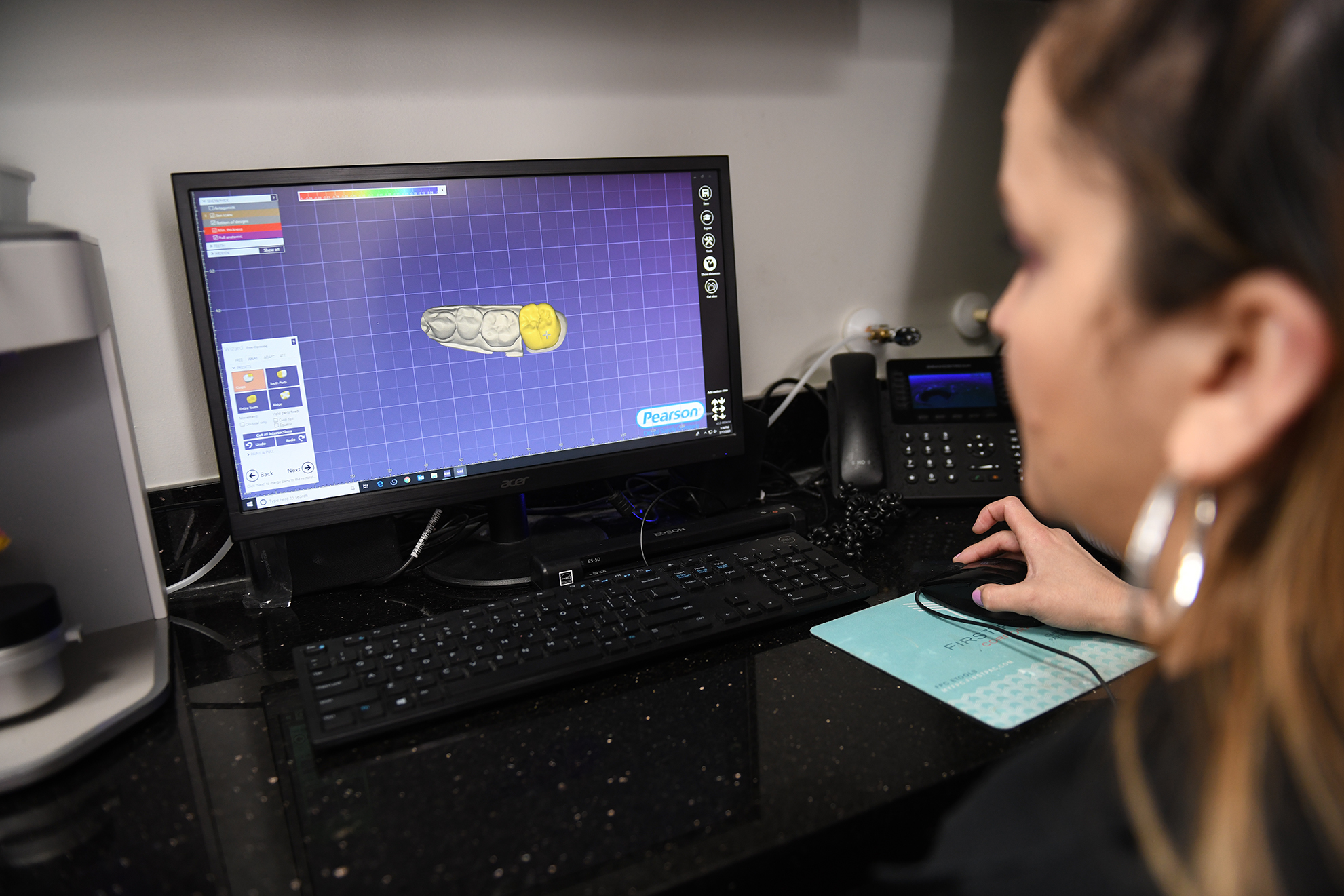 In Office Dental Lab Manvel TX - Manvel Dental & Implant Center