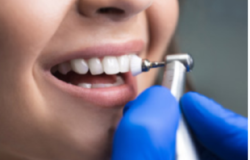 Top 5 Perks Of Professional Dental Cleaning